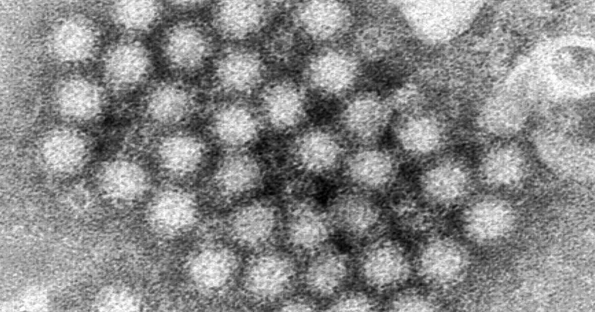 Norovirus outbreaks spiking in some states, CDC says | WORLD