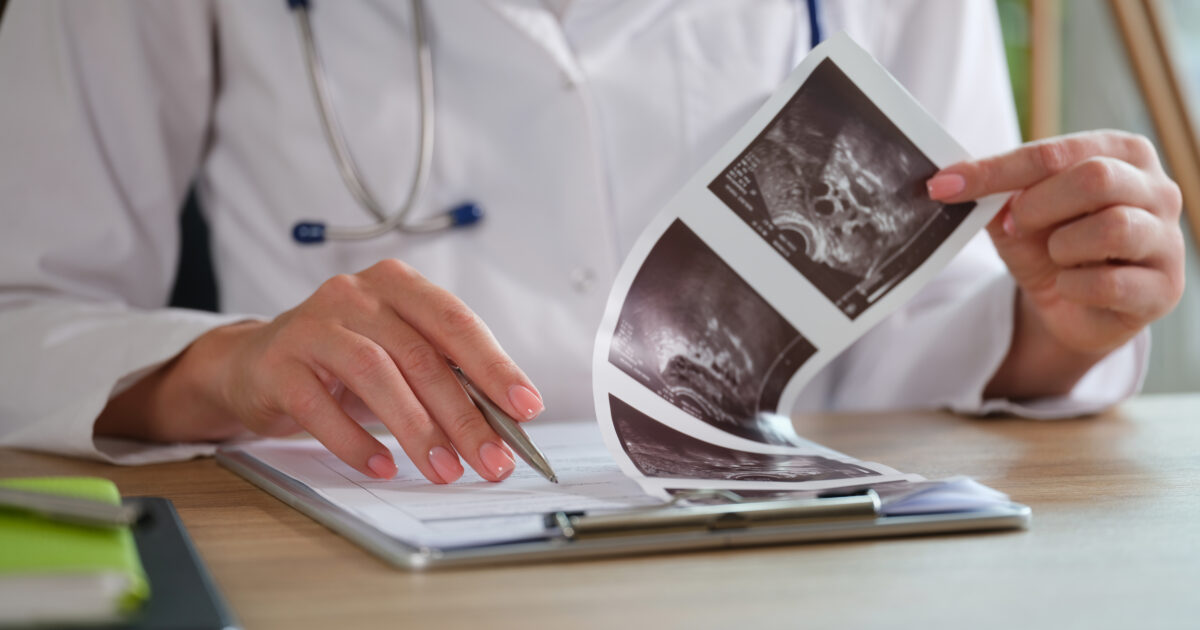 Pro-life doctors disagree on complex cases | WORLD
