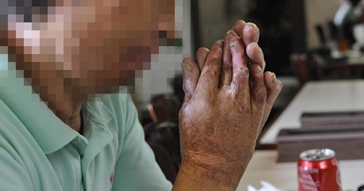 Beating the system | WORLD