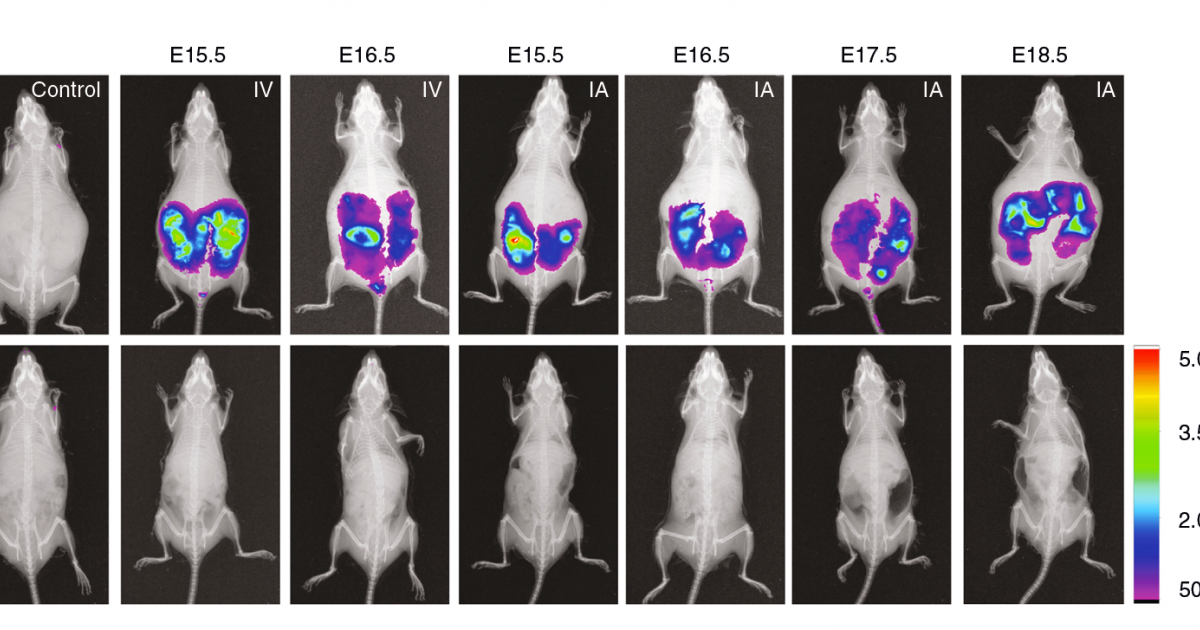 A birth defect breakthrough | WORLD