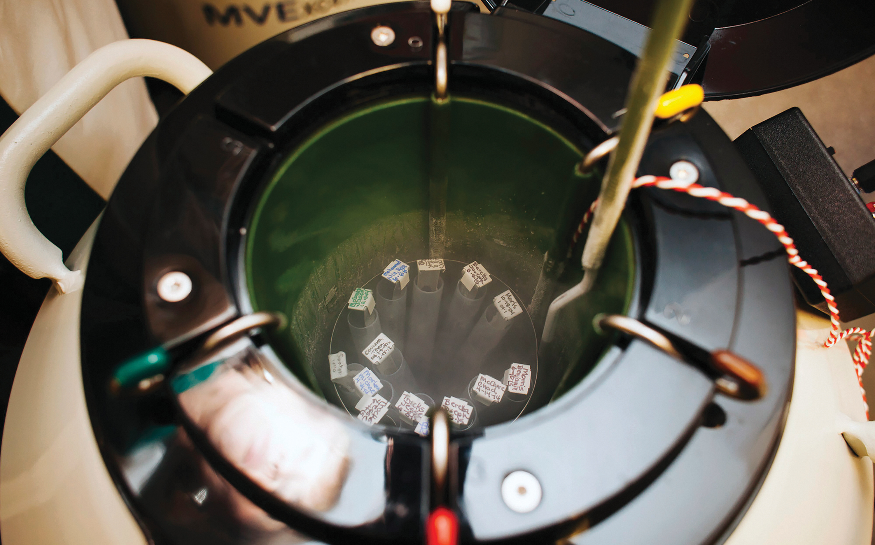 Embryo adoption's cold war | WORLD